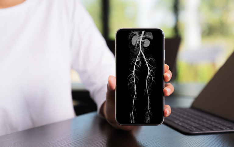 What is an Angiogram? - PAD Treatment Centers | USA Vascular Centers