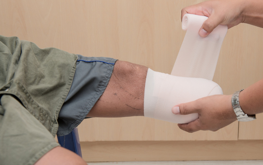 What Is Arterial Revascularization? | USA Vascular Centers