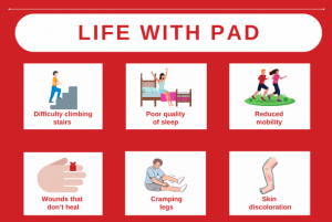 Skin Changes Linked to Peripheral Artery Disease