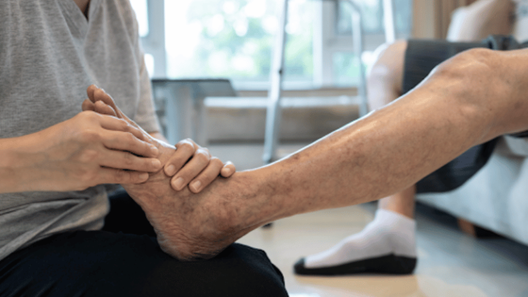 Smoking and Peripheral Artery Disease (PAD)