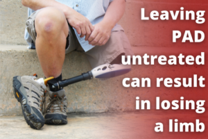 Peripheral Artery Disease Risk Assessment Quiz - PAD Treatment Centers