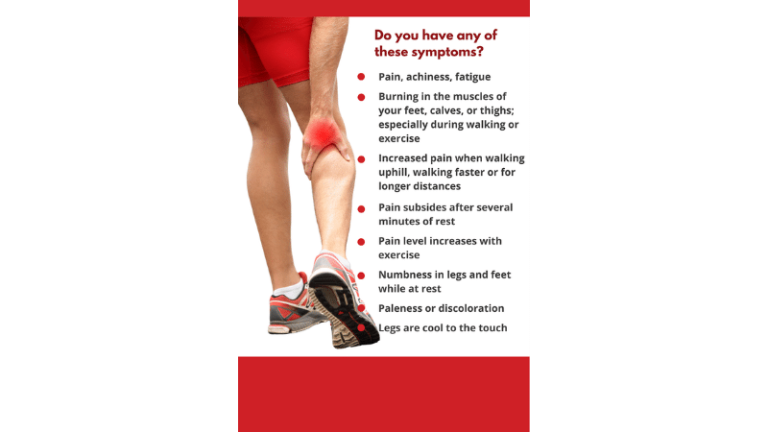 Why Are My Legs Tingling After Walking? | USA Vascular Centers