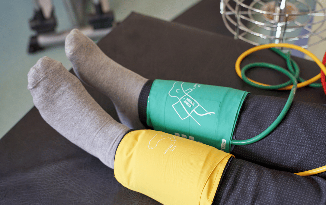 What Is a Peripheral Artery Disease (PAD) Test?