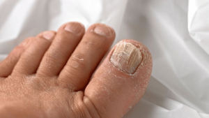 Why Are My Toenails Not Growing?